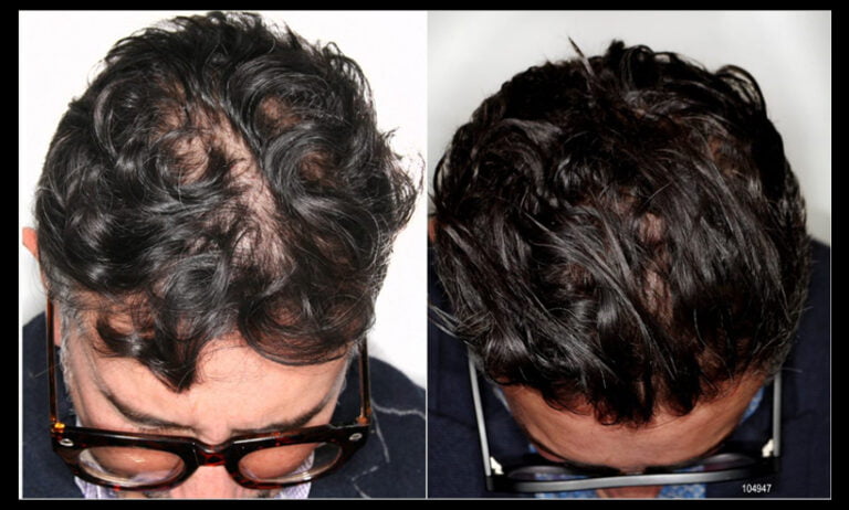 Treatment - Dr Adam Najem